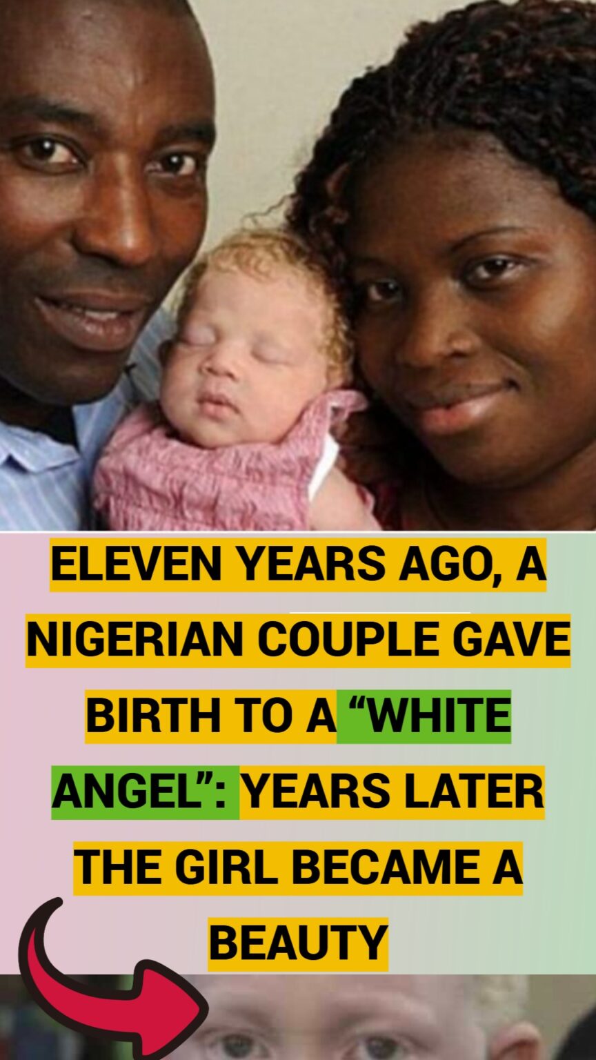 Eleven years ago, a Nigerian couple gave birth to a “white angel ...